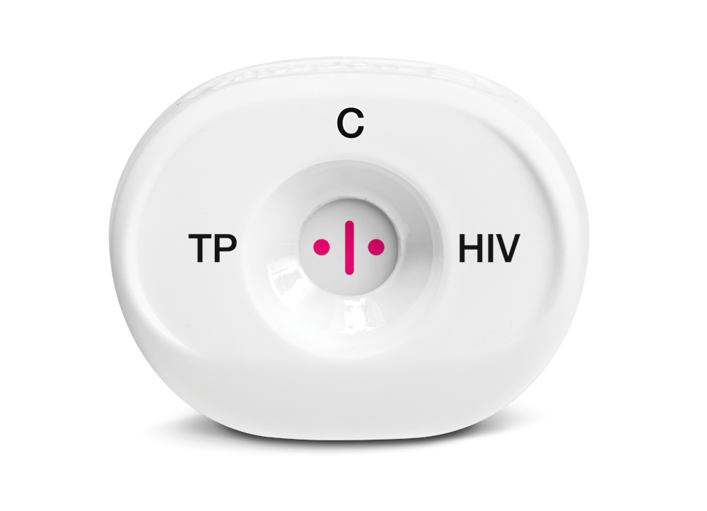 New HIV/syphilis test provides quick results – RCI | English New HIV/syphilis test provides quick results – RCI | English